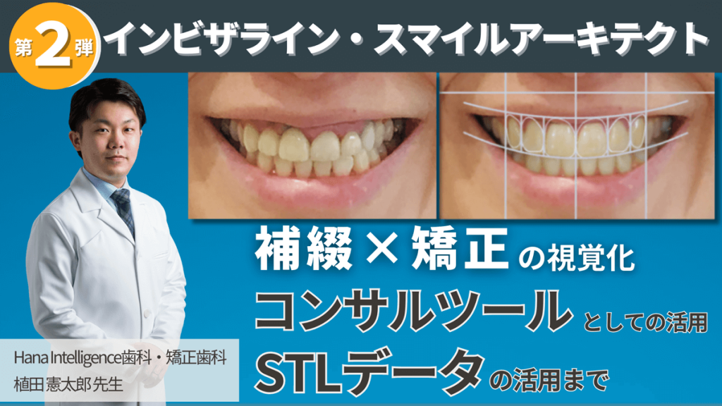 インビザライン・ジャパン合同会社 – Dentwave（デントウェーブ）